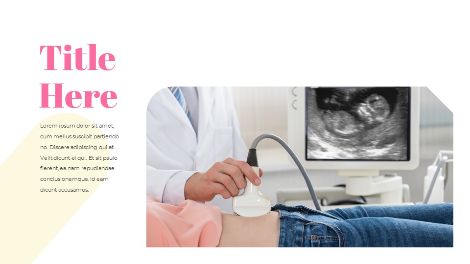 Pregnancy And Childbirth Creative Google Slides