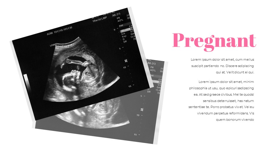 Pregnancy And Childbirth Creative Google Slides