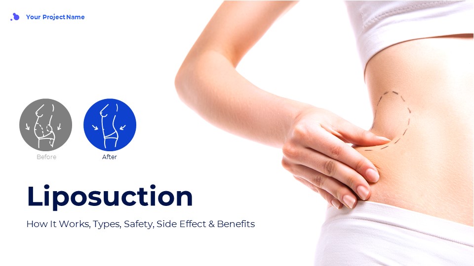 Plastic Surgery Easy Slides Design