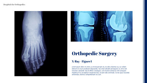 Orthopedics PowerPoint Presentations Samples
