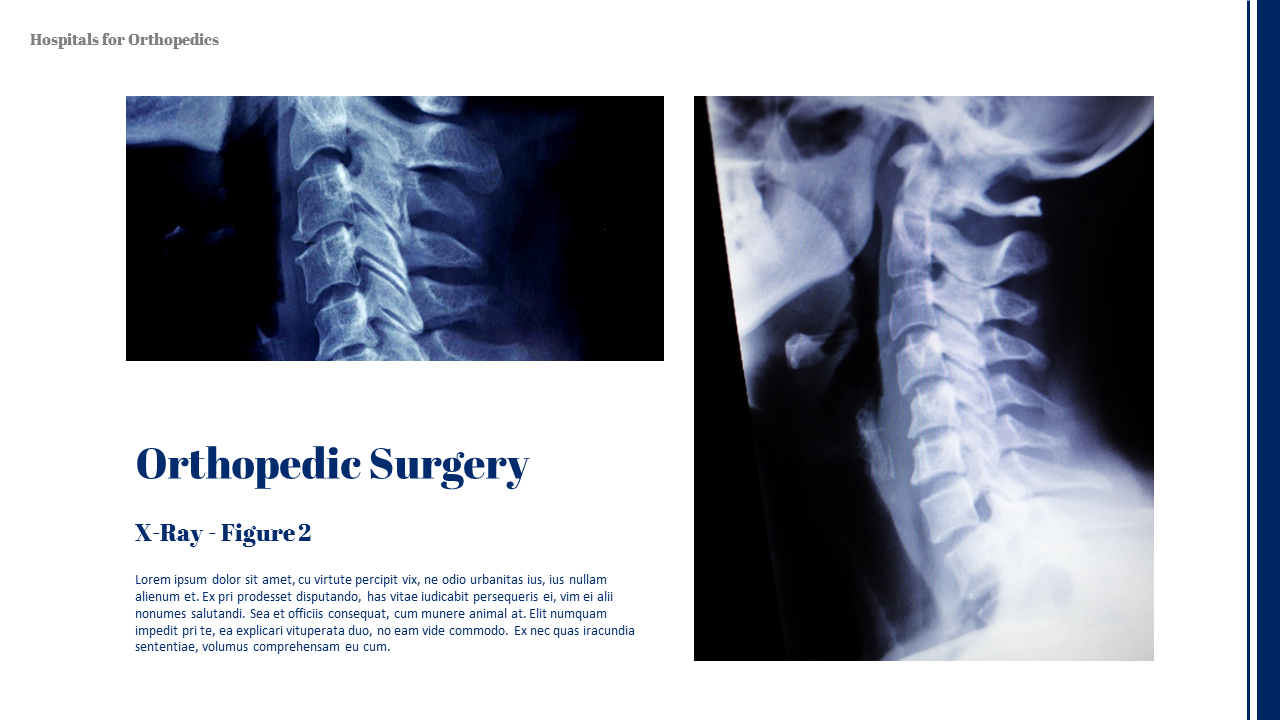 Orthopedics PowerPoint Presentations Samples