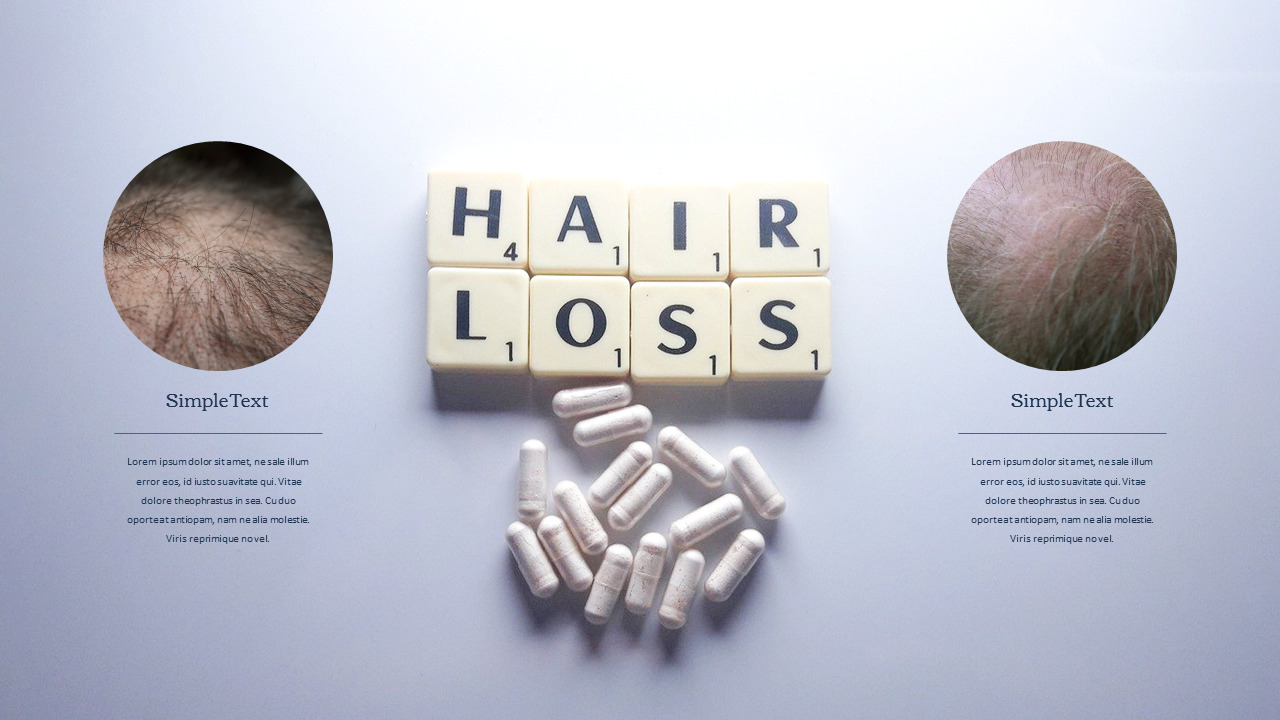 Hair Loss Treatments Business Plan Ppt Templates