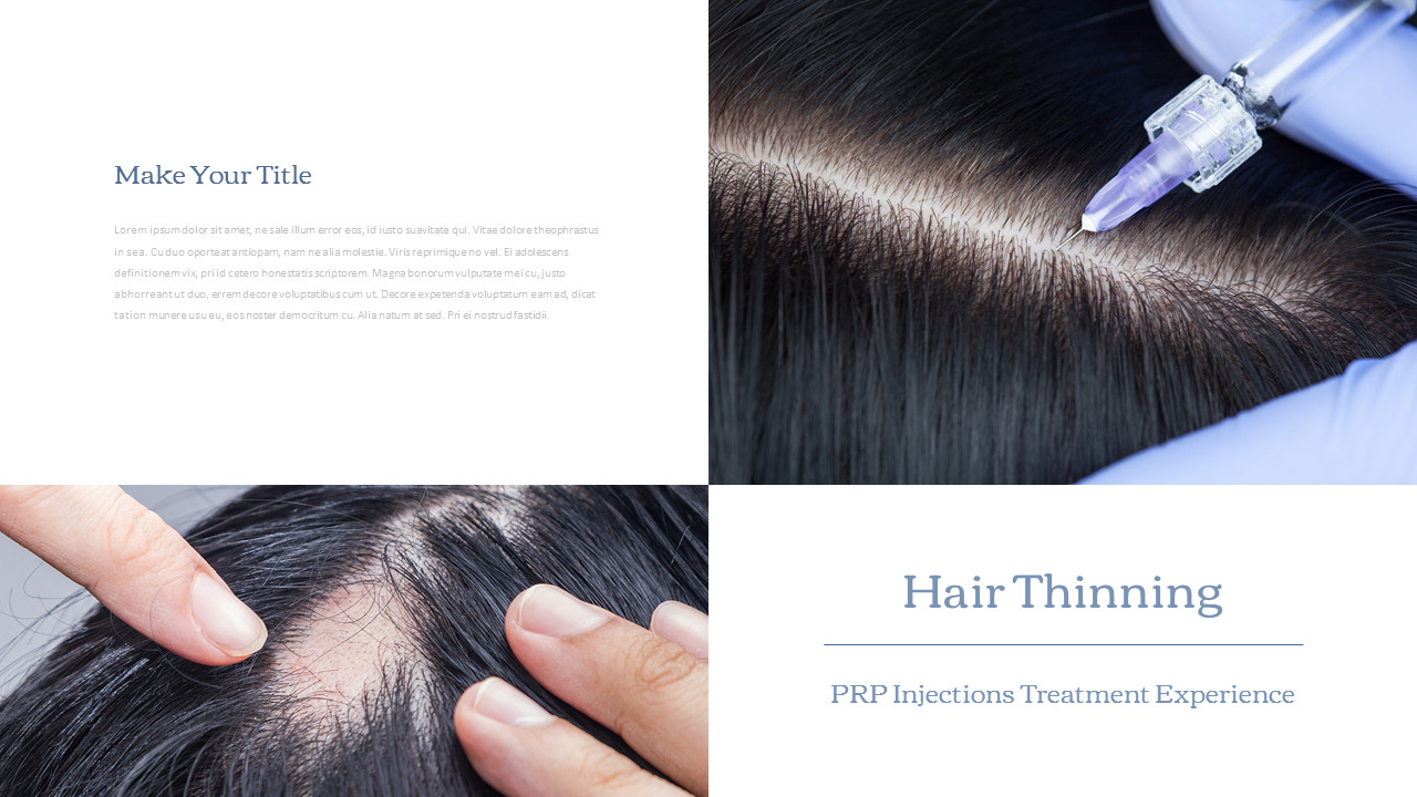 Hair Loss Treatments Business Plan Ppt Templates