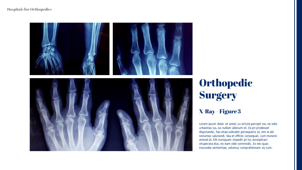 Orthopedics PowerPoint Presentations Samples